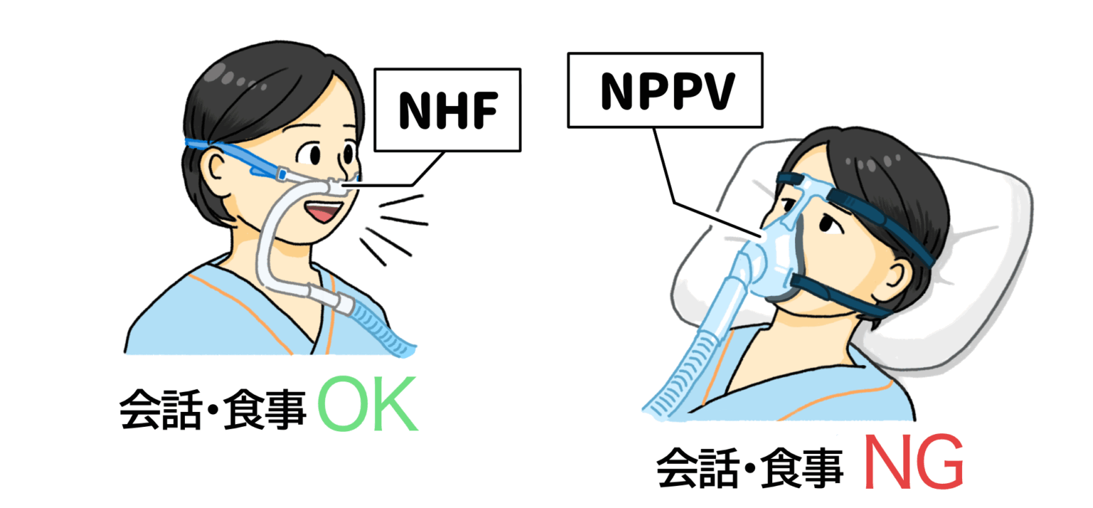ネーザルハイフローとNPPVの違い - ケアのあるある知恵袋ケアのあるある知恵袋