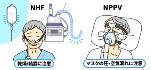 ネーザルハイフローとNPPVの違い - ケアのあるある知恵袋