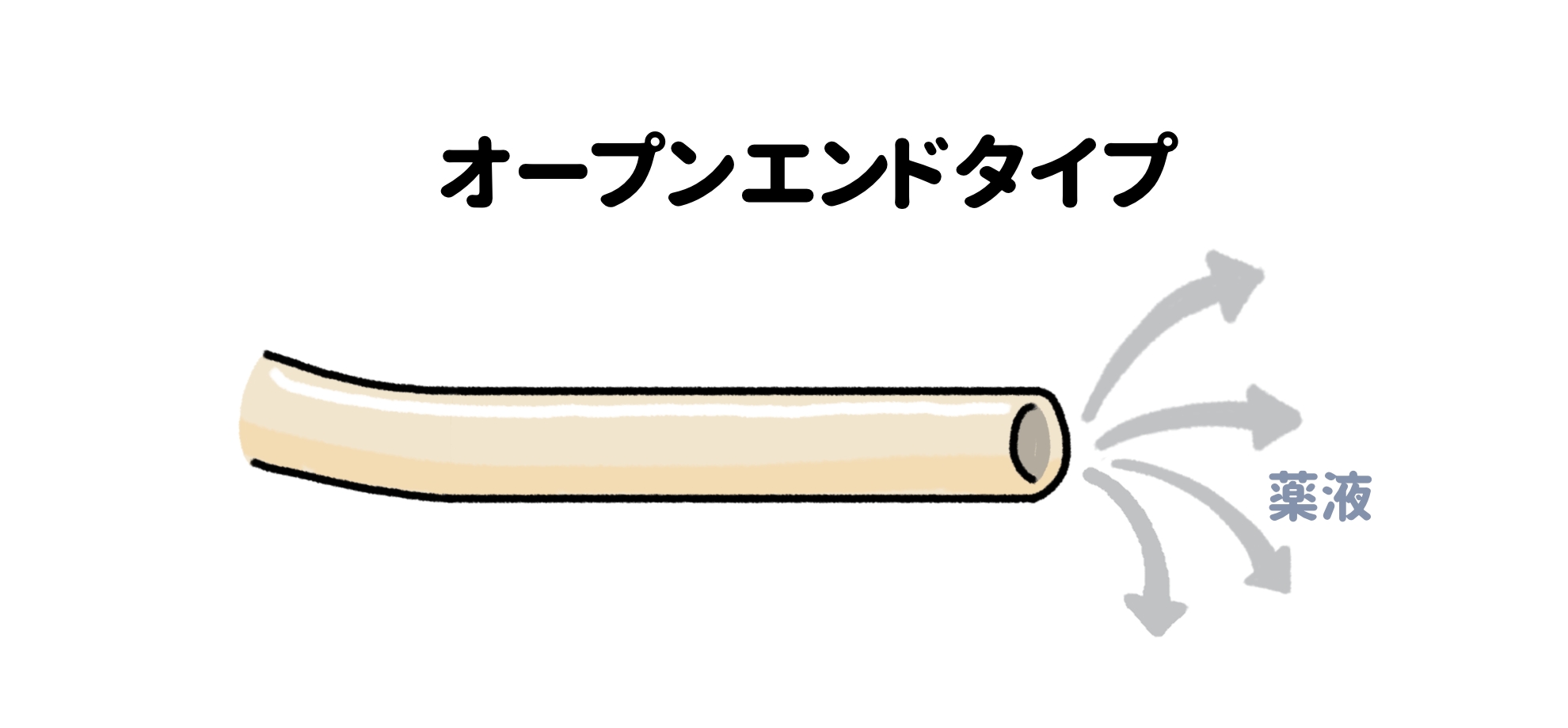 CVポートの仕組み知ってる？ちゃんと説明できる？CVポートの仕組みとタイプをおさらい - ケアのあるある知恵袋ケアのあるある知恵袋